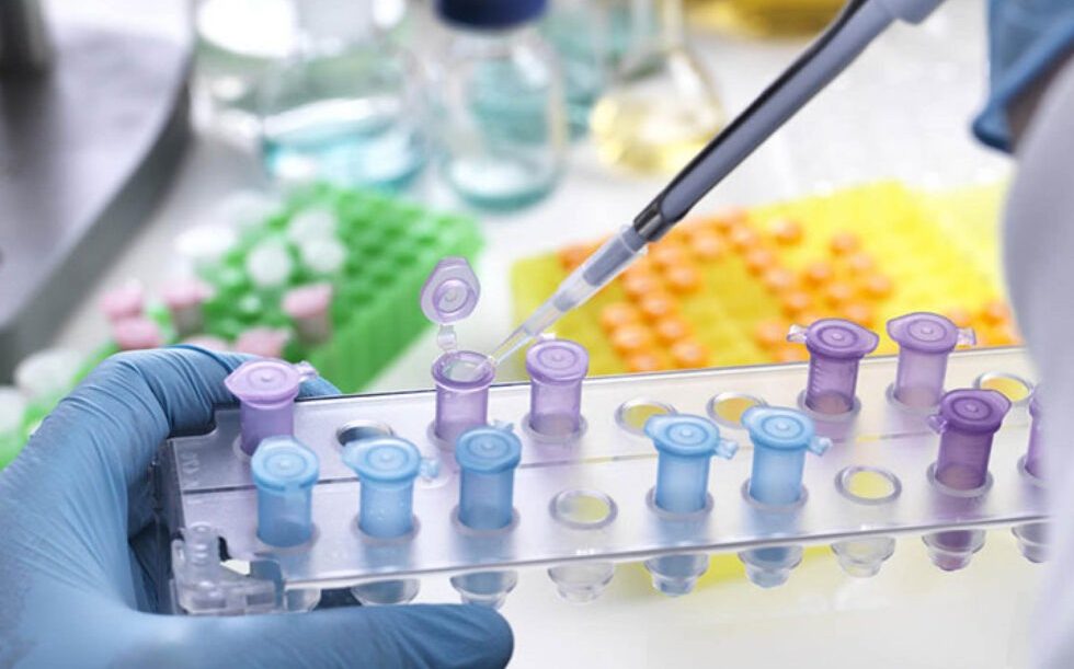 Edinburgh Innovations | Neurogene