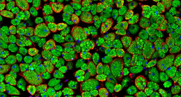 Edinburgh Innovations | FaTTy – a foundational cell line for