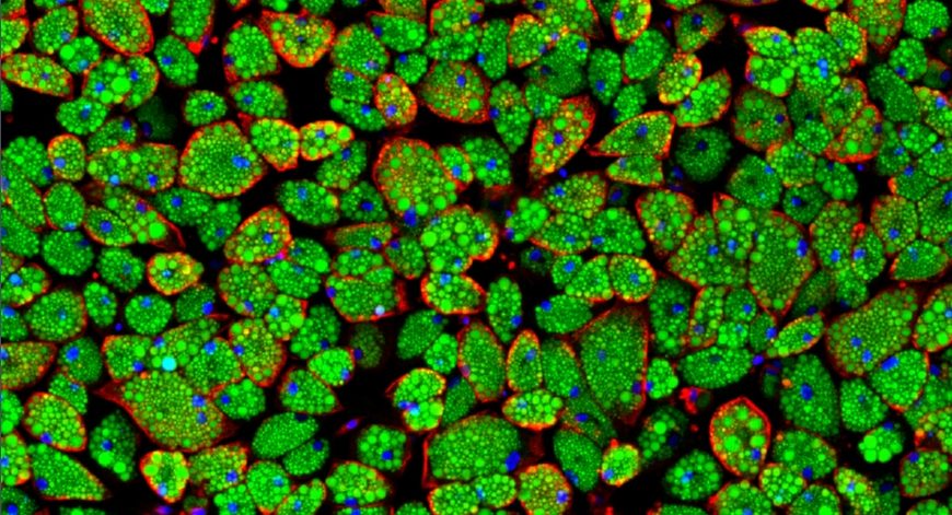 Edinburgh Innovations | FaTTy – a foundational cell line for