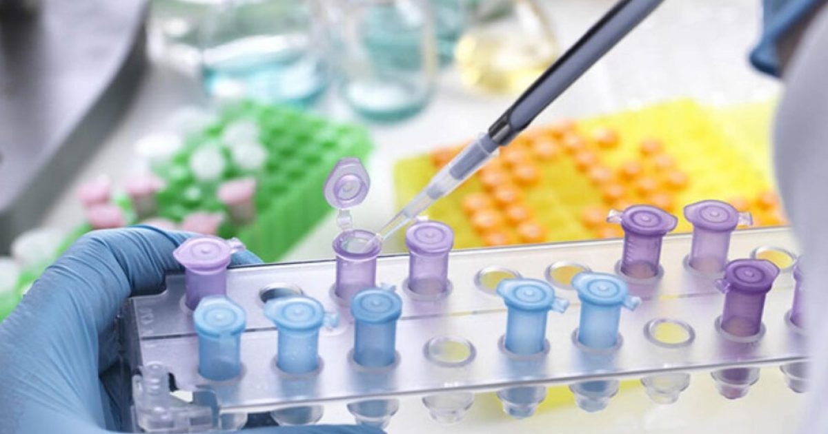 Edinburgh Innovations | Neurogene